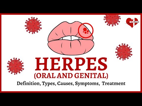 Herpes Explained: What You Need to Know About Oral and Genital Herpes