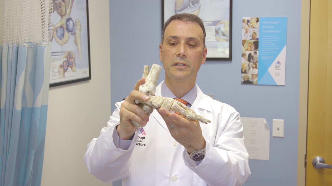 What causes flat feet?