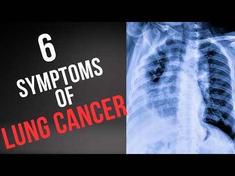 6 warning signs of lung cancer you should NEVER ignore