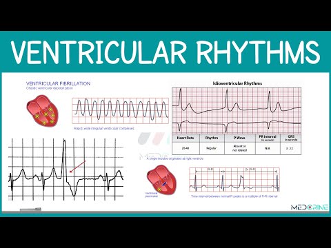 Mastering Ventricular Rhythms:Ventricular Tachycardia, Fibrillation & PVCs on ECG