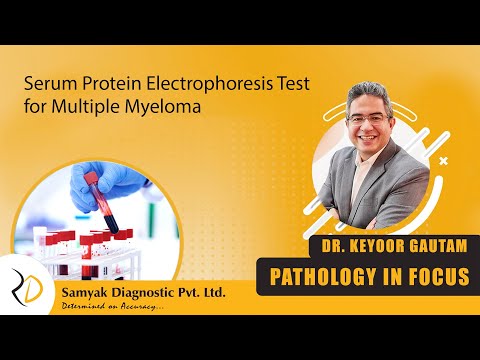 Episode 70| Serum Protein Electrophoresis Test for Multiple Myeloma
