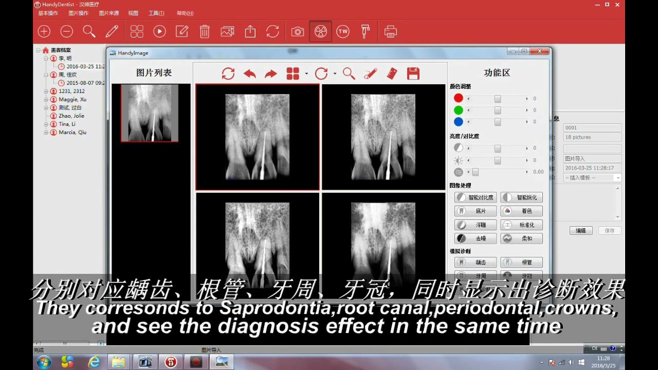 HandyDentist Digital Sensor & HandyImage Introduction
