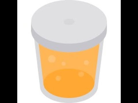 A Wee Bit of Effort: Analyzing Midstream Urine Collection Techniques in the Pre-Continent Age Group