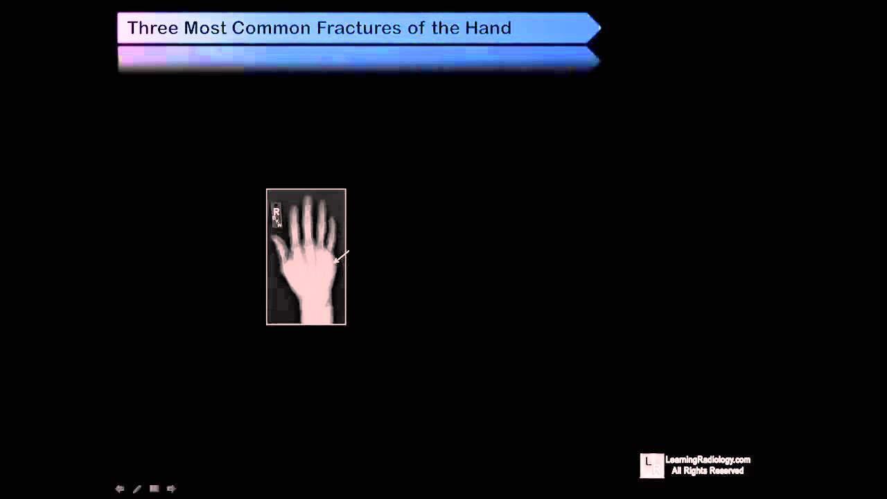 LearningRadiology.com Top Ten Video