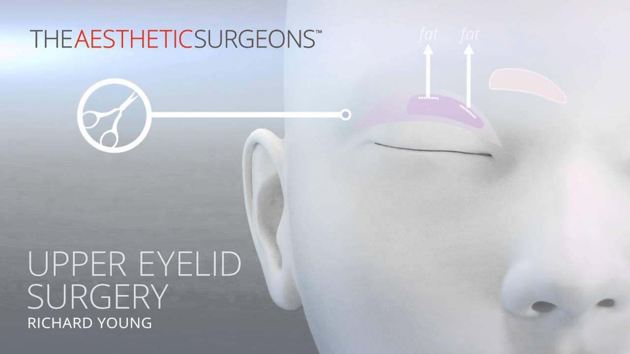 Eyelid Surgery | The Aesthetic Surgeons™ | HD