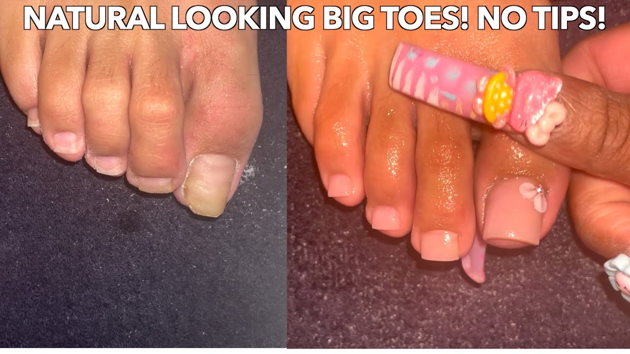ACRYLIC BIG TOE! + 3D FLOWER| ACRYLIC TOES OVERLAY NO TIPS!