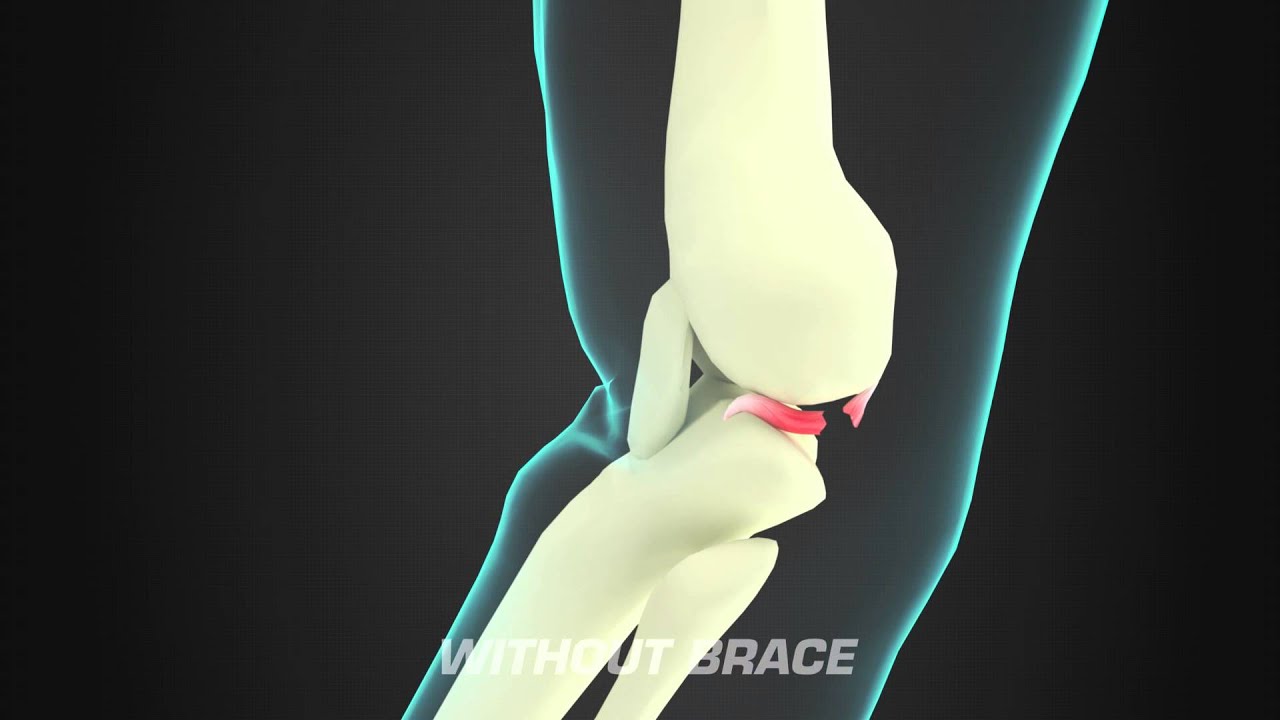 Leatt C-Frame Knee Brace Features Video
