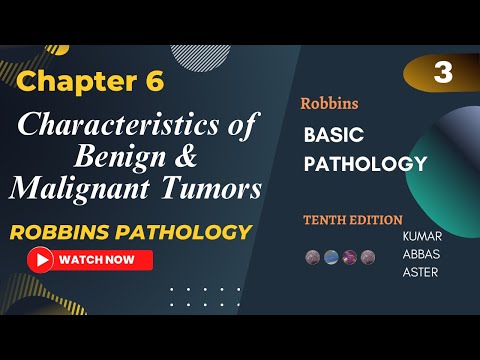 Characteristics Of Benign And Malignant Tumors | Neoplasia Chapter 6 Robbins Lecture 3