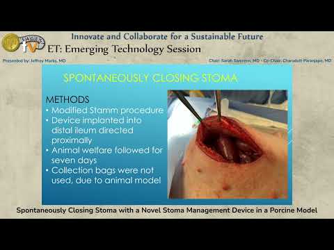 Spontaneously Closing Stoma with a Novel Stoma Management Device in a Porcine Model