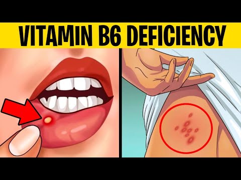 10 Signs of Vitamin B6 Deficiency People Always Ignore