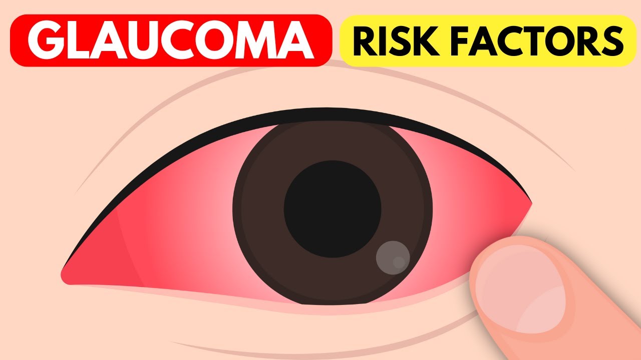 5 Glaucoma Risk Factors You Should Know