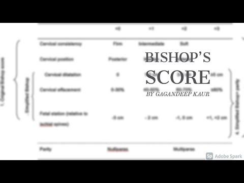 Bishop's Score | Table/Parameters| How to Read Results