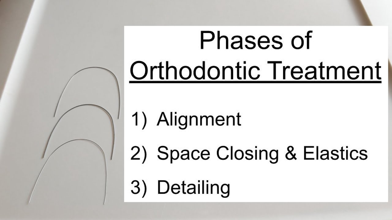 Phases of Tx & Wire Sequence