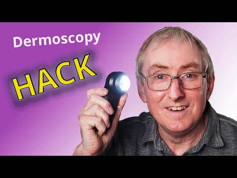 The greatest Dermoscopy Hack you've never heard of ['cos it's mine]