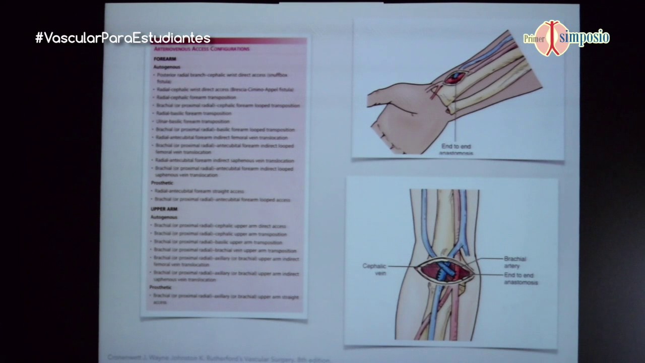 19) Generalidades de accesos vasculares - Dr. Gabriel López Peña (INCMNSZ)