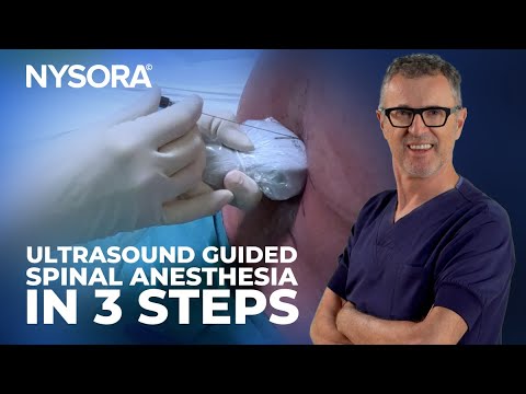 Ultrasound-Guided Spinal: How To
