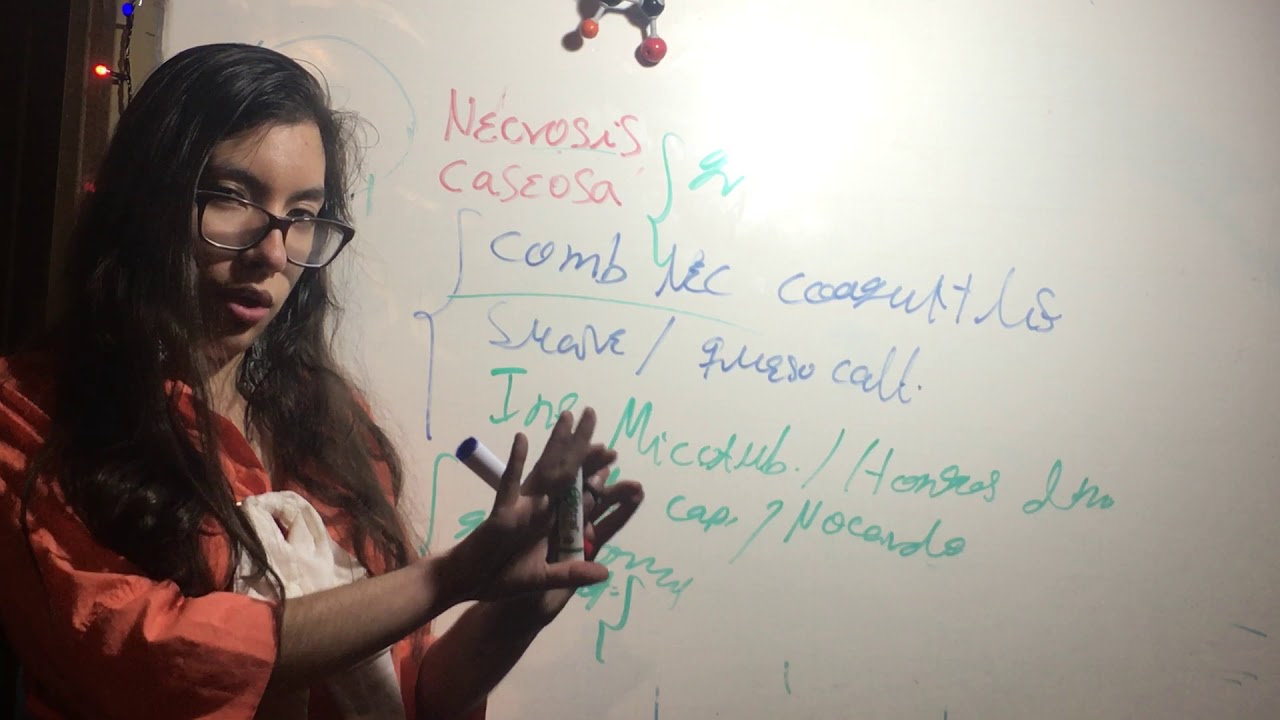Necrosis Caseosa