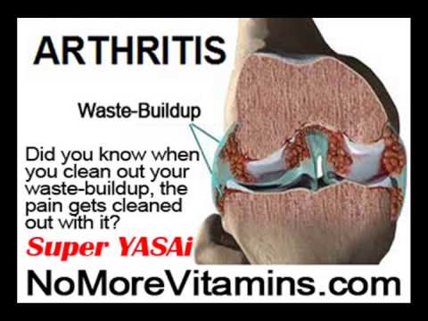 Crepitus Knee Treatment by NoMoreVitamins com