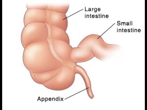 The Human Appendix Vestigial Organ Disproved. Dr. Jonathan Wells. Creation Evidence.