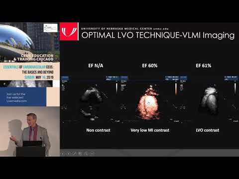LVO Rest & treadmill/bicycle and dobutamine stress echo / Quantitative myocardial perfusion imaging