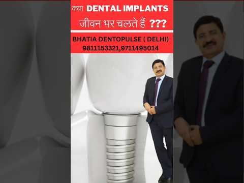 क्या डेंटल इंप्लांट्स जीवन भर चलते हैं-Life of Dental implants-#dentalimplant #lifeofdentalimplants