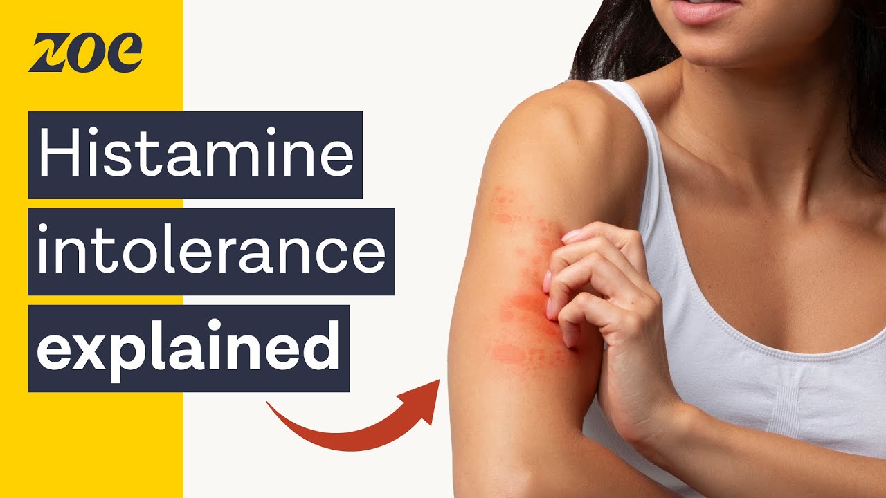 Understanding Histamine Intolerance: Causes, Symptoms, and Solutions | Galaxy.ai
