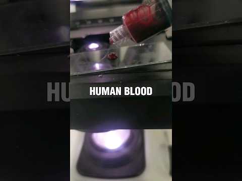 human blood under the microscope #laboratory #medtechstudent #mls #cls #bloodcells #microscope #bld
