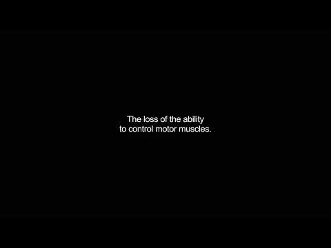 akinesia video Dictionary meaning and pronunciation