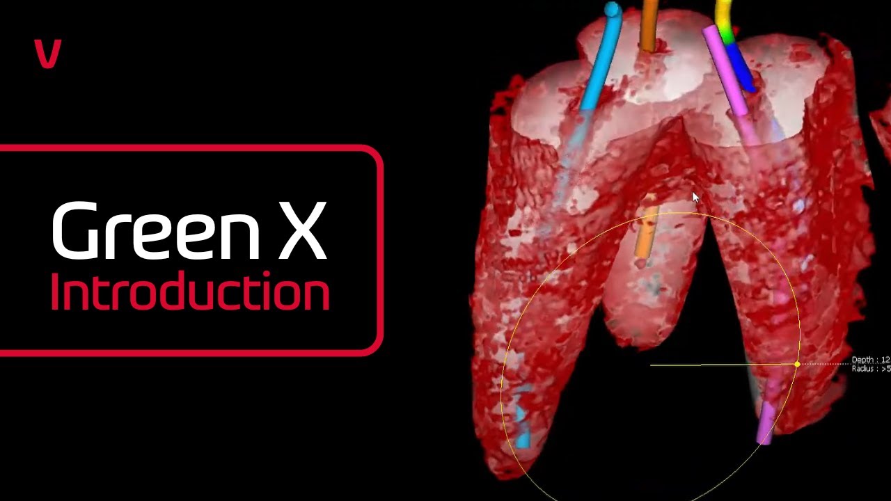 Green X Introduction