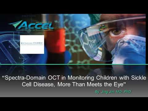 Spectra-Domain OCT in Monitoring Children with Sickle Cell Disease: More Than Meets the Eye