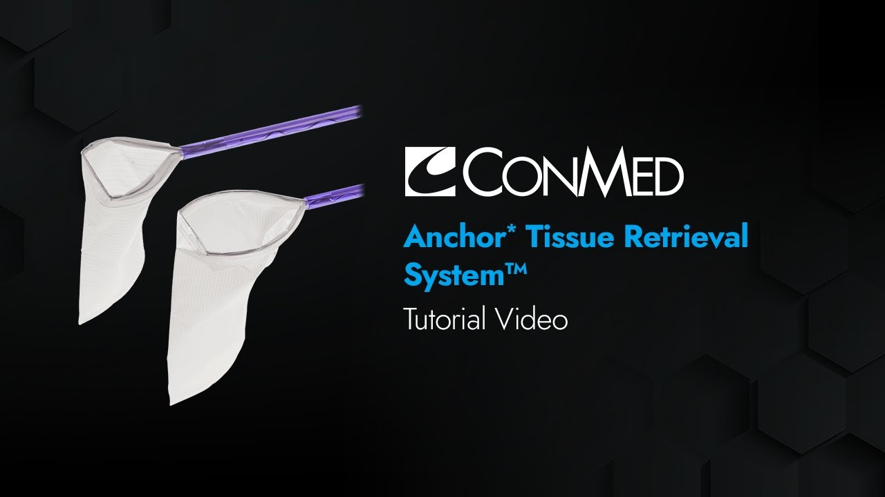 Anchor* Tissue Retrieval System™ - CONMED Tutorial Video