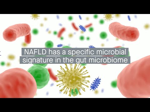 Identifying NAFLD-specific microbiome signatures in a Chinese population