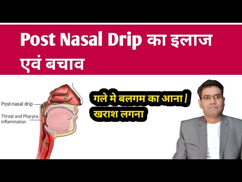 What is Post Nasal Drip? its Cause Symptoms and Treatment Explained (in Hindi)