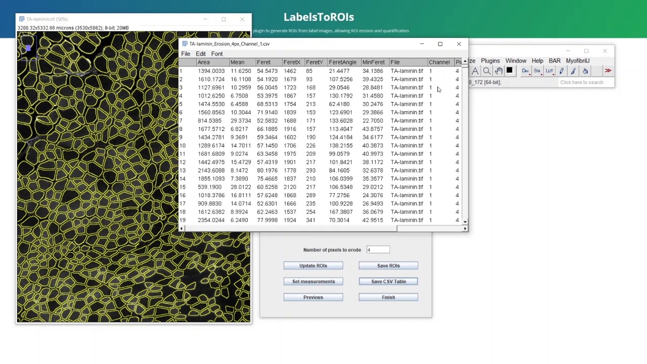 Tutorial for the LabelsToROIs FIJI/ImageJ plugin