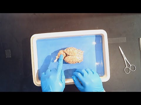 Sheep brain dissection - LIVE
