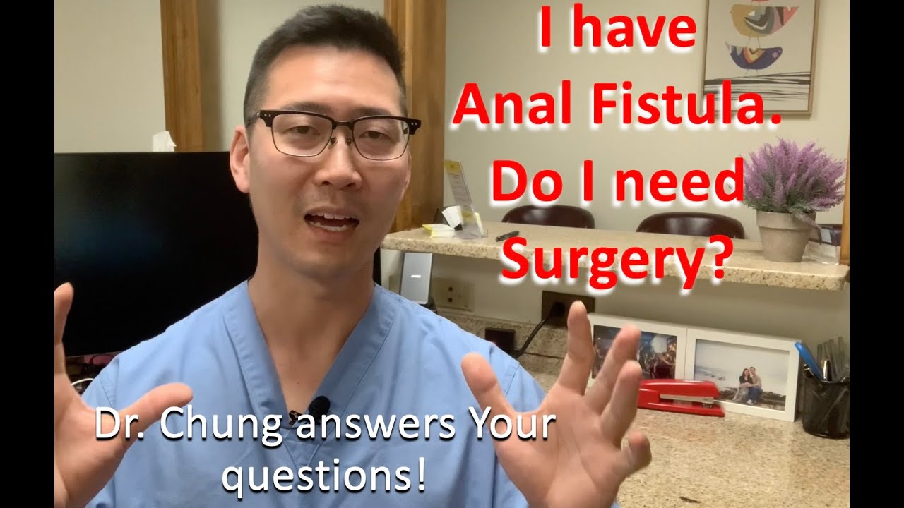 Doctors found an Anal Fistula. Do I need surgery? | Dr. Chung answers YOUR questions!