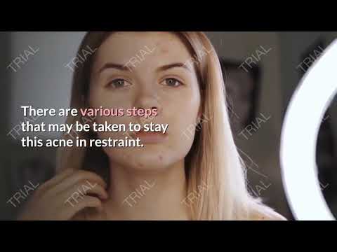 Acne vulgaris: Causes, symptoms, and treatment options