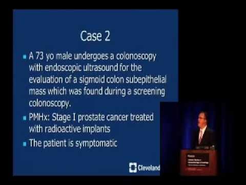 John J. Vargo, MD, Cleveland Clinic GI Board Review ERCP and EUS Questions