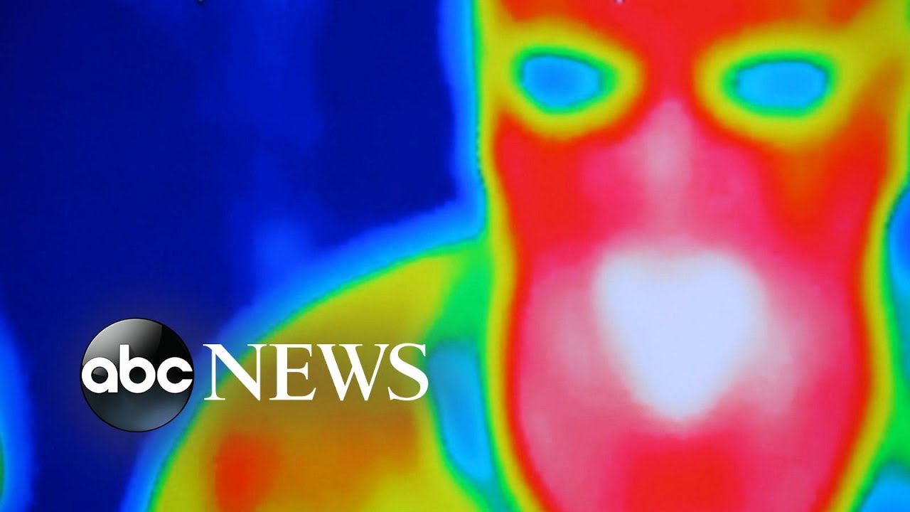 Breast cancer survivor shares cautionary tale about thermography | GMA