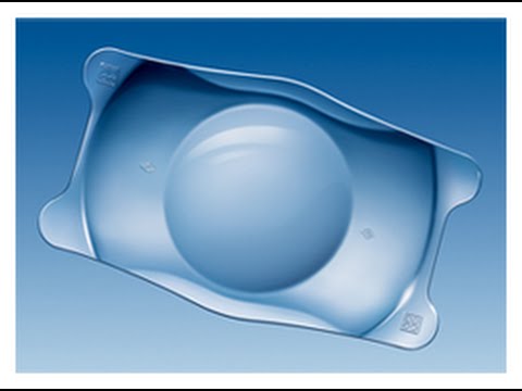 STAAR® Surgical's phakic IOL for myopia and hyperopia