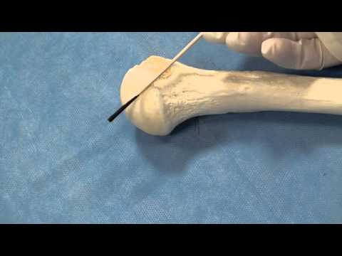 The Humerus