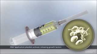 Patient Education in Orthopedic Surgery – OrthoPedia Patient