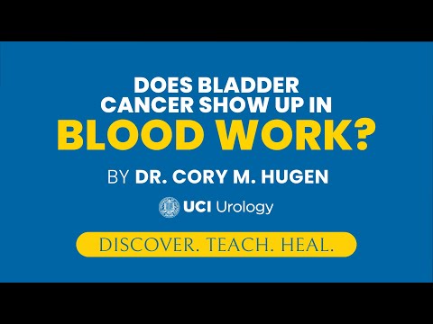 Does Bladder Cancer Show up in Blood Work? by Dr. Cory Hugen - UCI Department of Urology