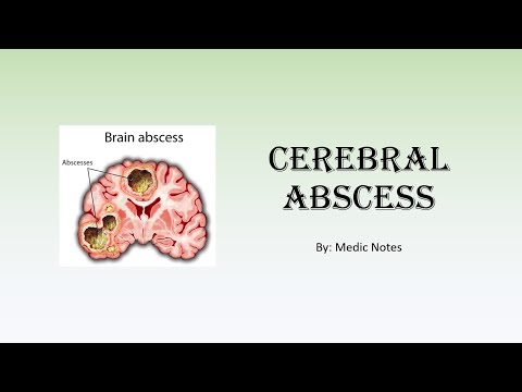 Cerebral abscess - causes, common sites and origin, complications