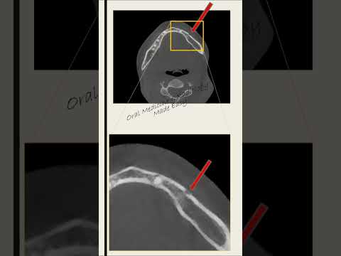 INTERPRETATION OF CBCT IMAGES- Q1