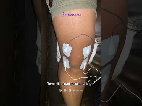 Alat fisio lagi nih 🙌🏻 #fisioterapi #nyeriotot #pengapuran #osteoarthritis