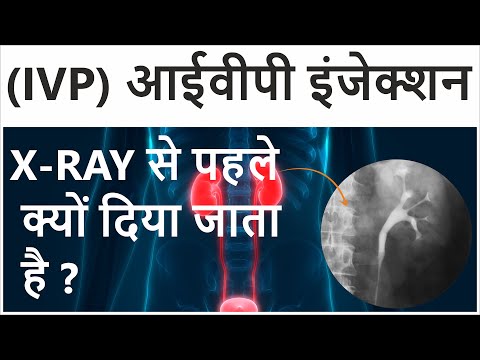 Intravenous Pyelogram in Hindi || Intravenous Pyelogram Procedure || IVP Test for Kidney