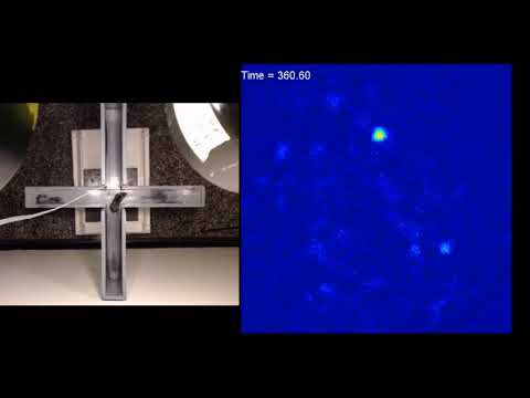 ‘Anxiety Cells’ Identified in the Brain’s Hippocampus