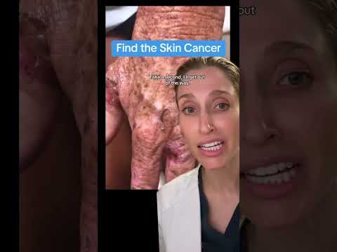 It’s a game that could save your skin. #skincancer