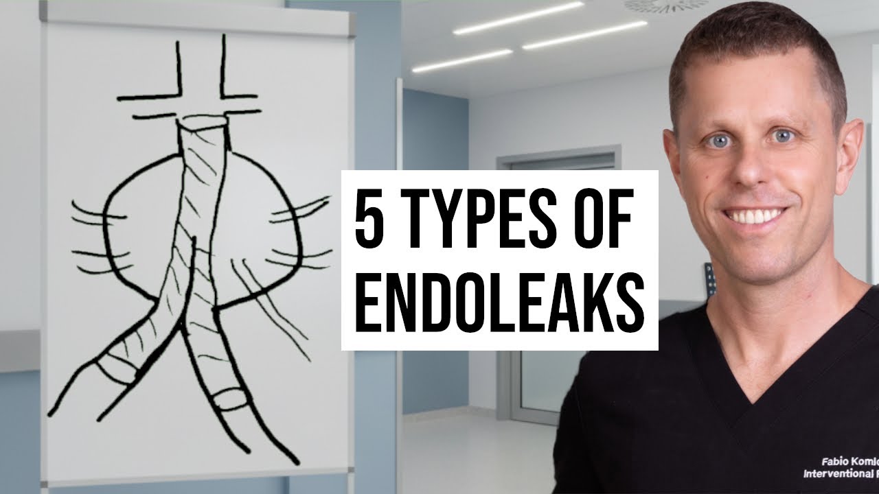 Endoleaks Explained: A Guide for Patients and Doctors